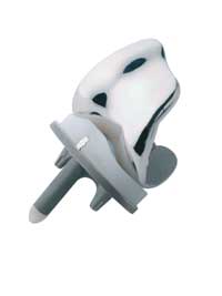 Knee Replacement Surgery - Deep Venous Thrombosis - Pulmonary embolism ...